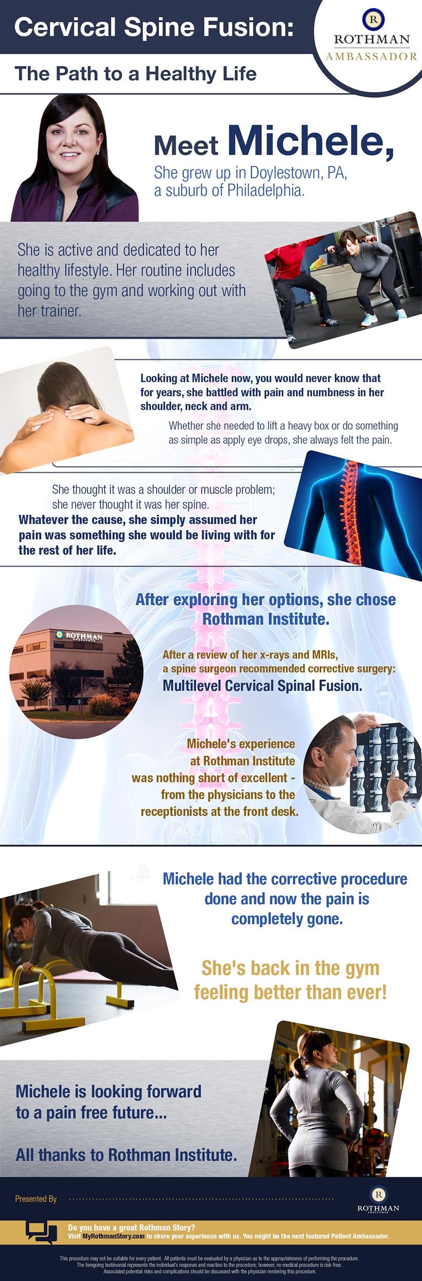 Cervical Spine Fusion - Rothman Orthopaedics