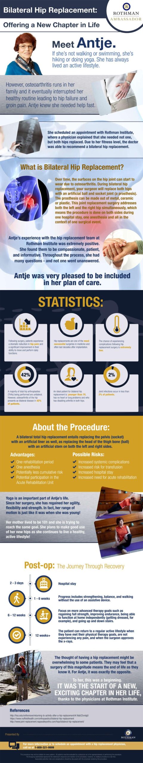 Bilateral Hip Replacement Procedure | Rothman Orthopaedic Institute ...
